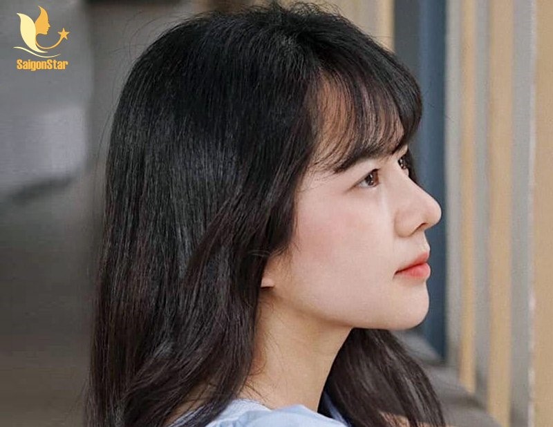 Lệch vách ngăn mũi – Nguyên nhân và cách điều trị