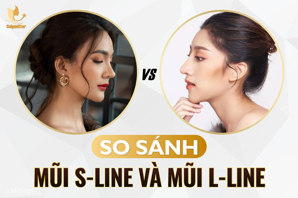 Nâng mũi S Line và L Line khác nhau như thế nào?