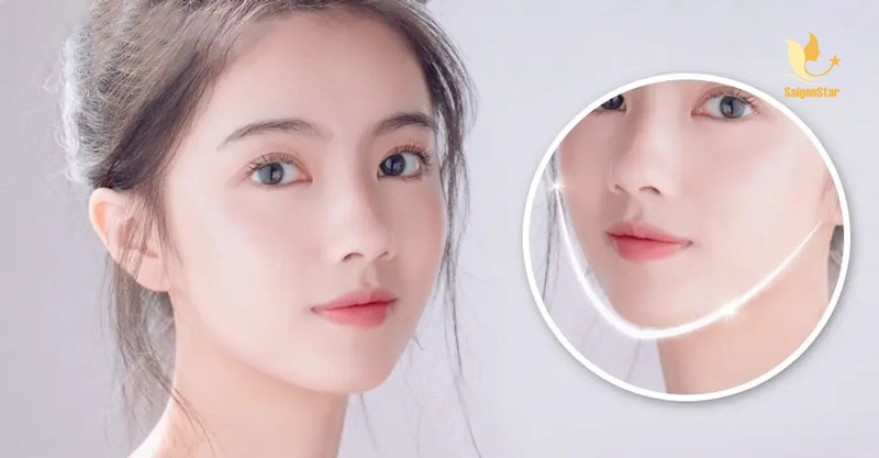 Mặt Vline là gì? Cách tạo mặt Vline tại nhà hiệu quả